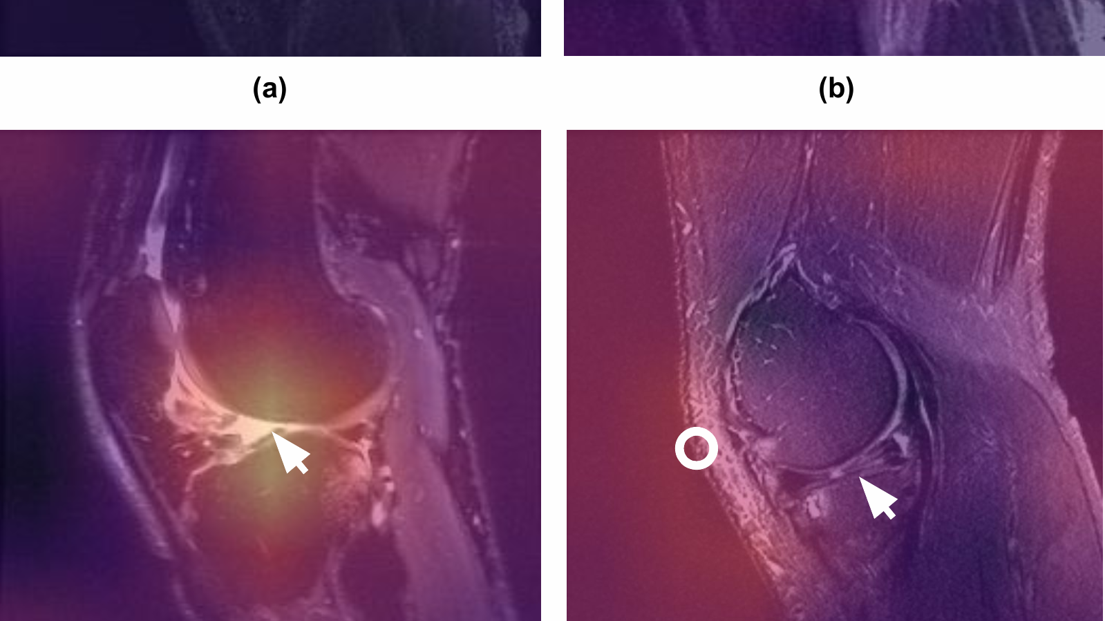 Rontgen I AI Fracture Recognition Software – Rontgen Trauma uses ...